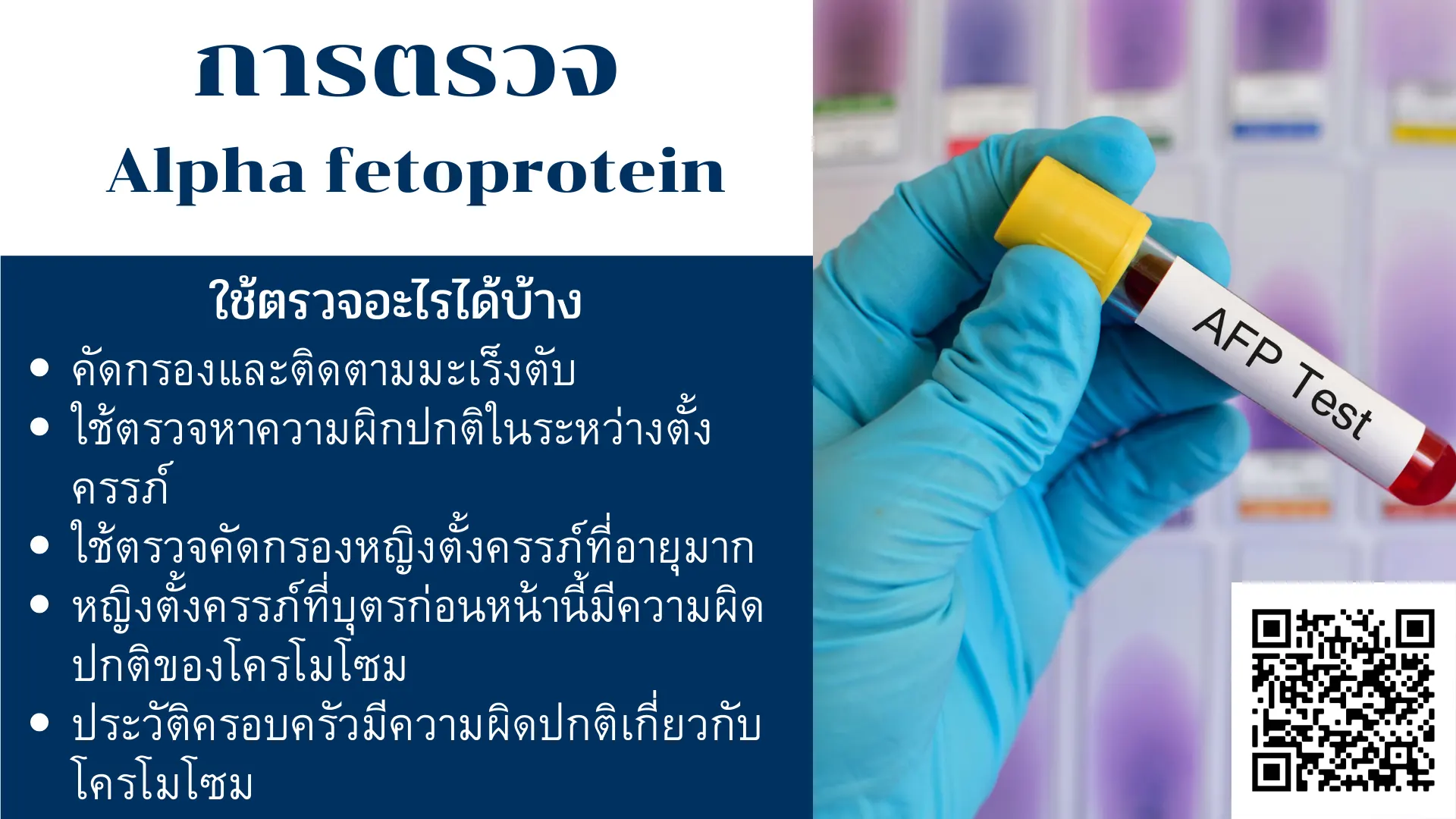 Alpha – fetoprotein (AFP)
